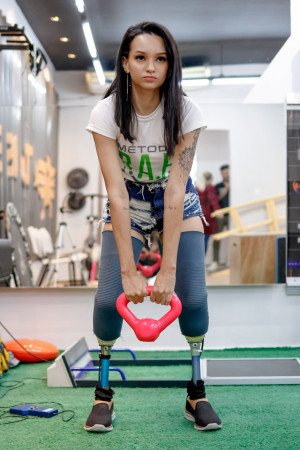 Liberdade de andar: método ensina amputados a usarem prótese em ...