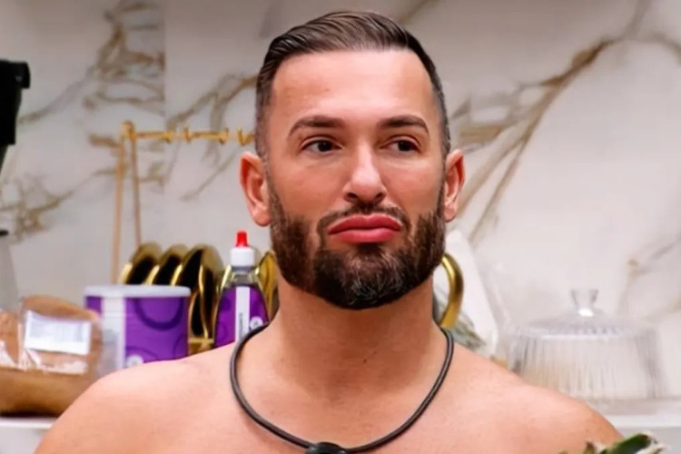 BBB 25: entenda transplante de cabelo e barba feito por Diego Hypólito